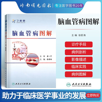  脑血管病图解 徐蔚海 临床实用脑血管治疗学医学工具书籍可搭脑血管病和神经介入技术手册中国管理指南 人民卫生出版社