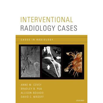 Interventional Radiology Cases