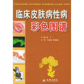 临床皮肤病性病彩色图谱 赵广