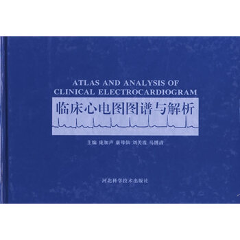 临床心电图图谱与解析