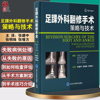 足踝外科翻修手术 策略与技术 张建中 张明珠 张增方 译 外科学书籍 平足症手术和距下关节融合 北