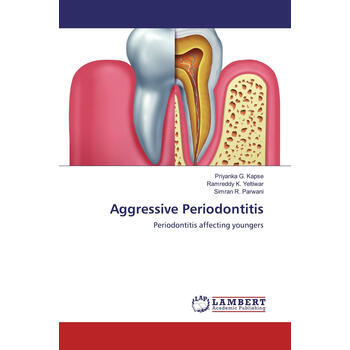 Aggressive Periodontitis