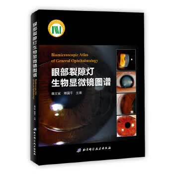 眼部裂隙灯生物显微镜图谱