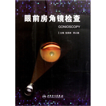 眼前房角镜检查 张莉林, 阴正勤