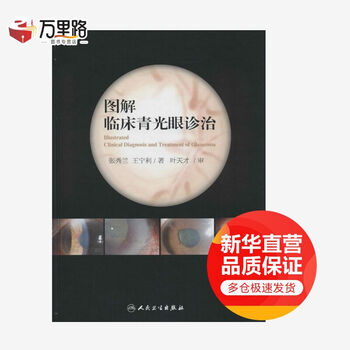 图解临床青光眼诊治