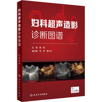 妇科超声造影诊断图谱 图书