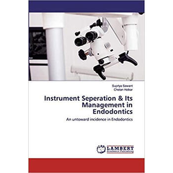 Instrument Seperation & Its Management in Endodo