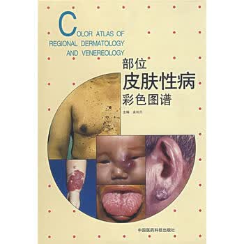 部位皮肤性病彩色图谱 虞瑞尧　编著【正版书】