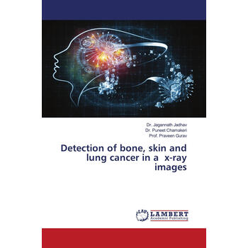 Detection of bone, skin and lung cancer in a x-r