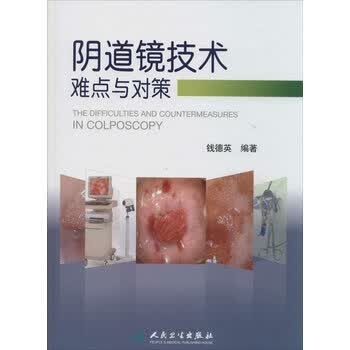 镜技术难点与对策【正版图书】