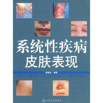 包邮  系统性疾病皮肤表现  虞瑞荛　编著  化学工业出版社