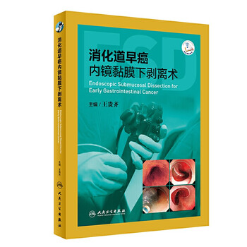 消化道早癌内镜黏膜下剥离术 内科学 肿瘤学 内镜黏膜下剥离术 肿瘤书籍 医学类书籍 王贵齐 主编