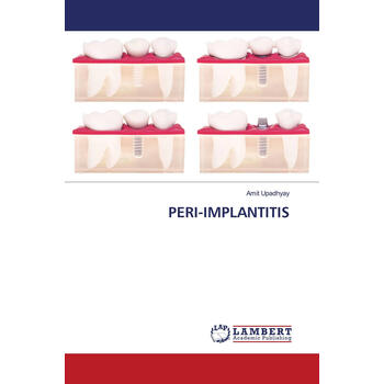Peri-Implantitis