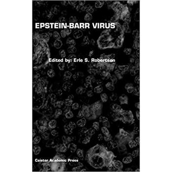 Epstein-Barr Virus