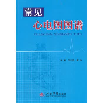 常见心电图图谱