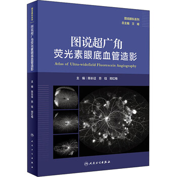 图说超广角荧光素眼底血管造影 图书