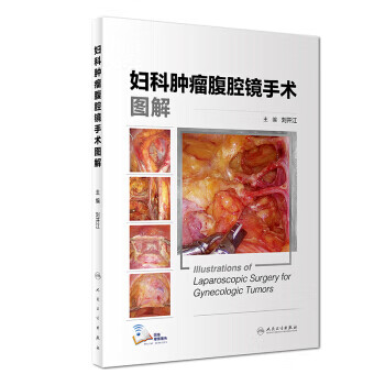 妇科肿瘤腹腔镜手术图解 刘开江 著