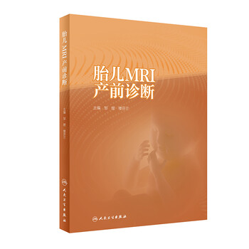 胎儿MRI产前诊断(精)