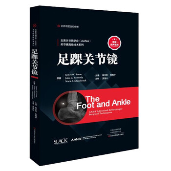 足踝关节镜