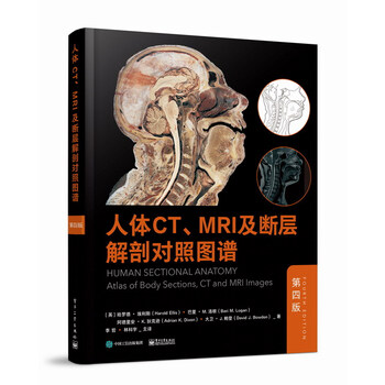 人体CT、MRI及断层解剖对照图谱（第四版）