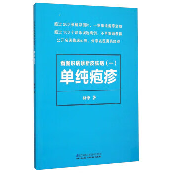 看图识病诊断皮肤病一单纯疱疹