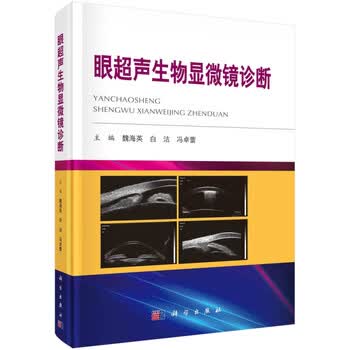 眼超声生物显微镜诊断