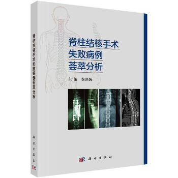 脊柱结核手术失败病例荟萃分析