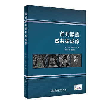 前列腺癌磁共振成像（配增值） 王建业,陈敏