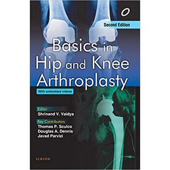 Basics in Hip and Knee Arthroplasty