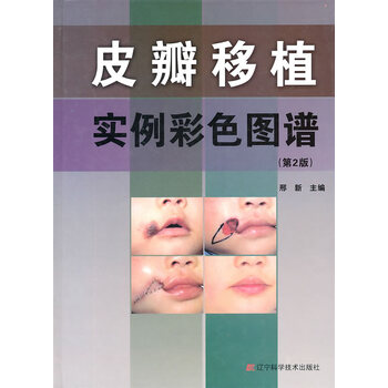 皮瓣移植实例彩色图谱第2版