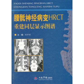 腰骶HRCT重建同层显示图谱【正版图书】