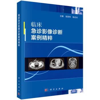 【新华正版】 临床急诊影像诊断案例精粹 张思伟,陈志光 著 科学出版社