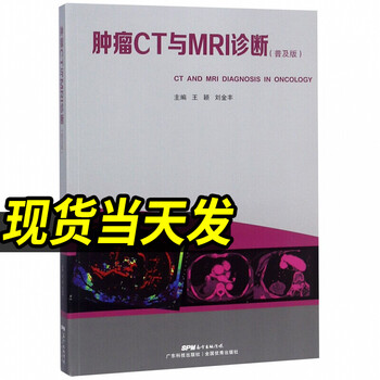 肿瘤CT与MRI诊断(普及版)