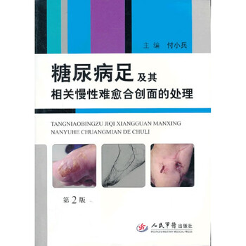  糖尿病足及其相关慢性难愈合床面的处理第2版 付小兵　主编  人民