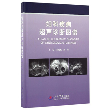 妇科疾病超声诊断图谱