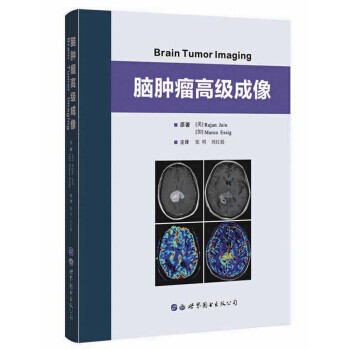 脑肿瘤高级成像【正版图书】