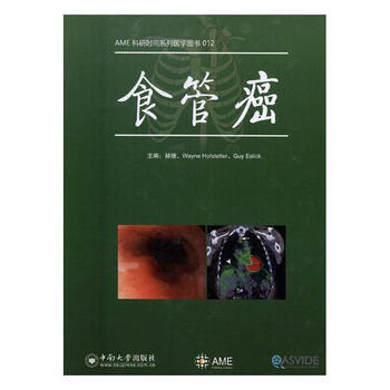 食管癌医学食管癌诊疗 图书
