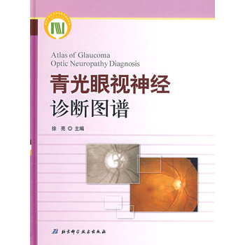 青光眼视神经诊断图谱 徐亮主编【正版书】