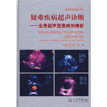 疑难疾病超声诊断--全身超声显像 富京山 人民军医出版社 9787509132944
