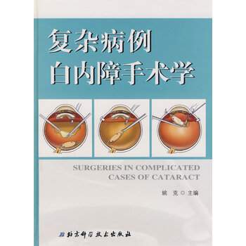 复杂病例白内障手术学