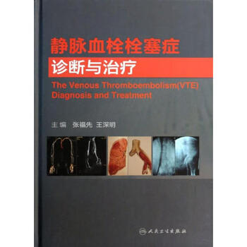 静脉血栓栓塞症诊断与治疗