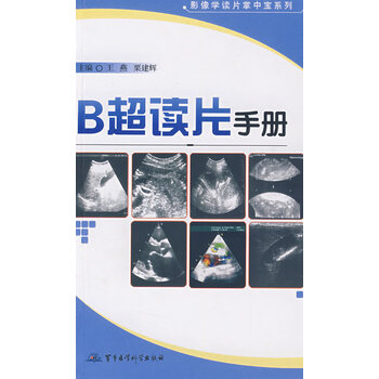B超读片手册——影像学读片掌中宝系列 王燕,栗建辉 主 军事医科出版社【正版图书】
