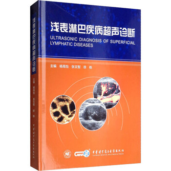 浅表淋巴疾病超声诊断 图书