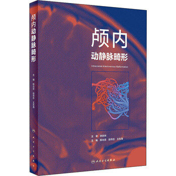 颅内动静脉畸形