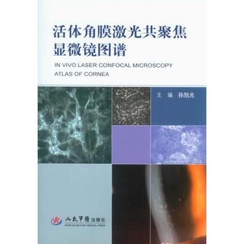 活体角膜激光共聚焦显微镜图谱
