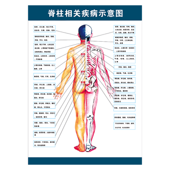 中医宣传画挂图中药配伍禁忌歌十八反十九畏歌脊柱图墙贴画WSA WSA37 脊柱相关疾病示意图 80*60厘米 覆膜防水PP贴纸