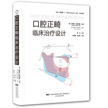 口腔正畸临床治疗设计