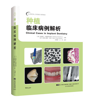 种植临床病例解析9787559109736辽宁科技王凤
