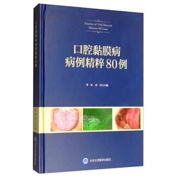 口腔黏膜疑难病例精粹80例