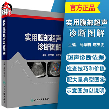 正版 实用腹部超声诊断手册图解 刘学明 蒋天安主编 人民卫生出版社 腹部疾病 超声波诊断图解 医学超